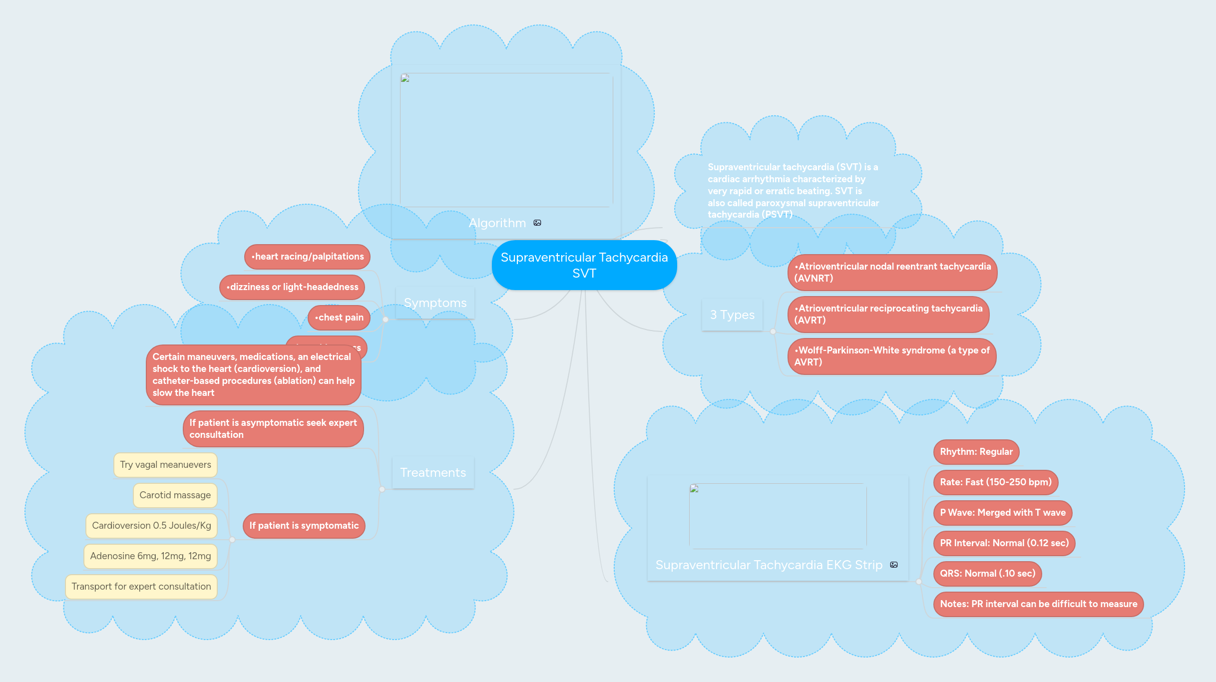 Supraventricular Tachycardia SVT | MindMeister Mind map