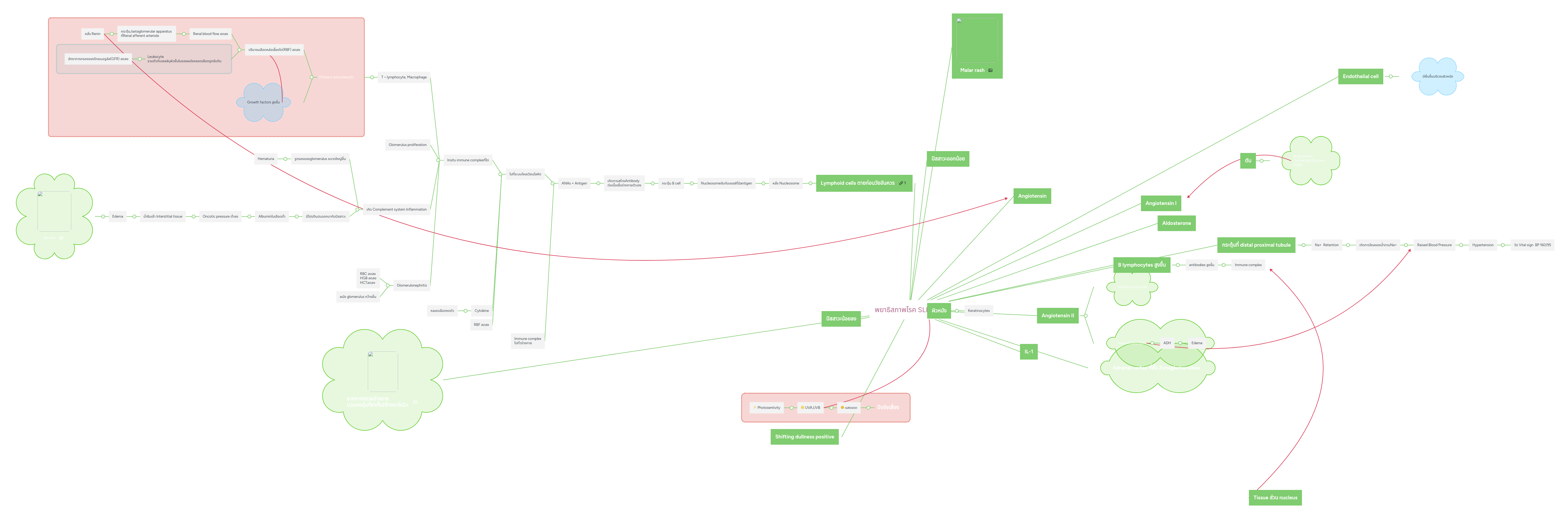 พยาธิสภาพโรค SLE | MindMeister Mind Map