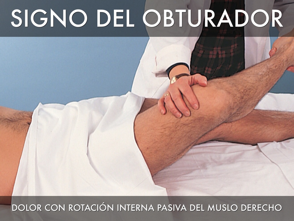 Signo Del Psoas
